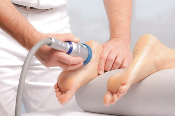 Terapia de Ondas de Choque - Fisioterapia y Rehabilitación